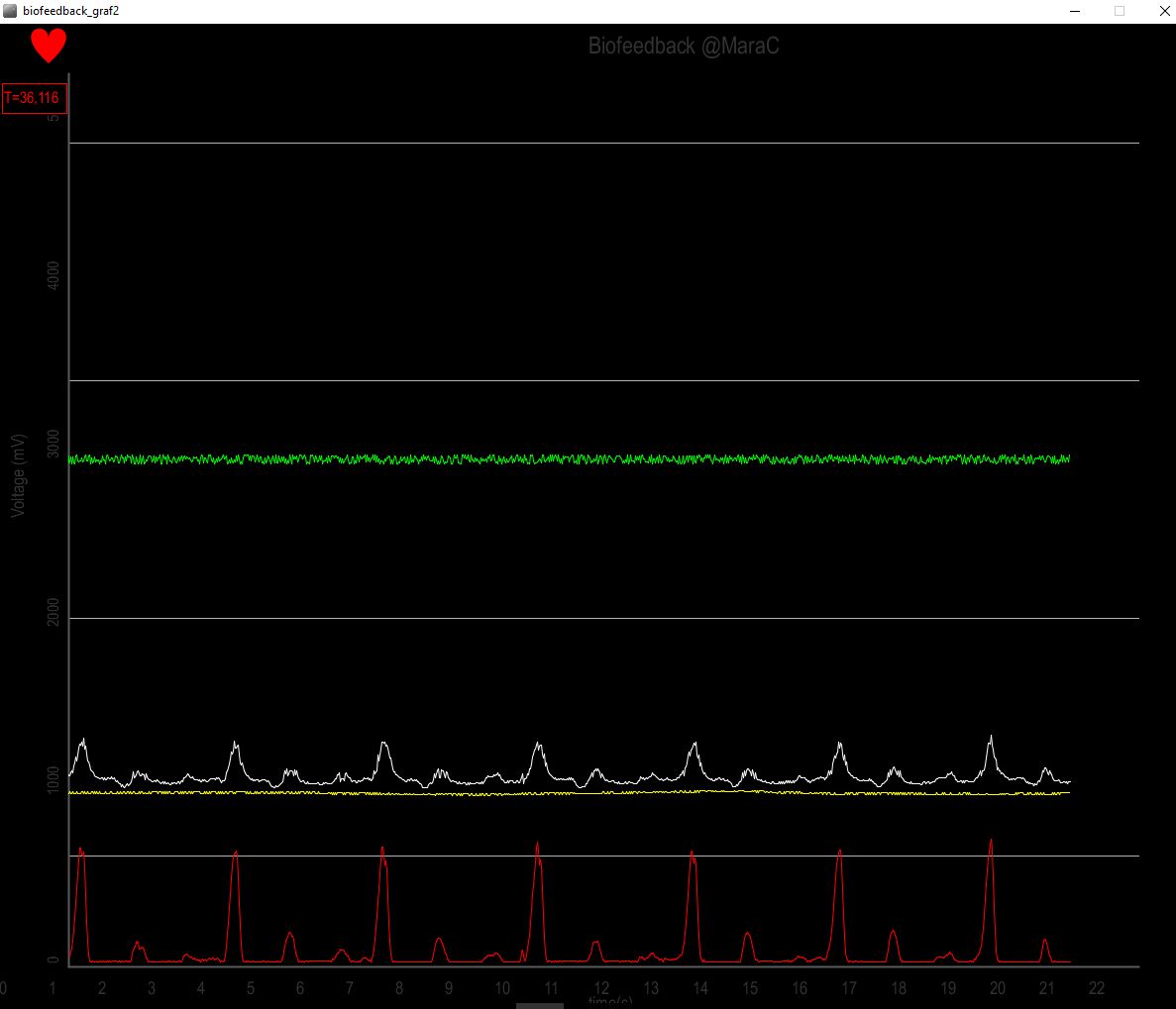 Biofeedback Measurement Instrument Trybotics 