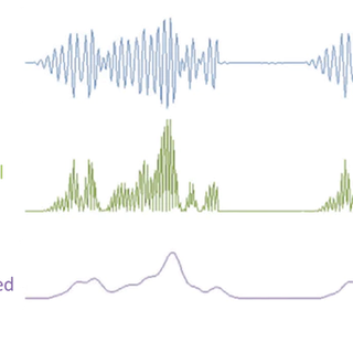 DIY Muscle Sensor / EMG Circuit for a Microcontroller : 13 Steps (with ...