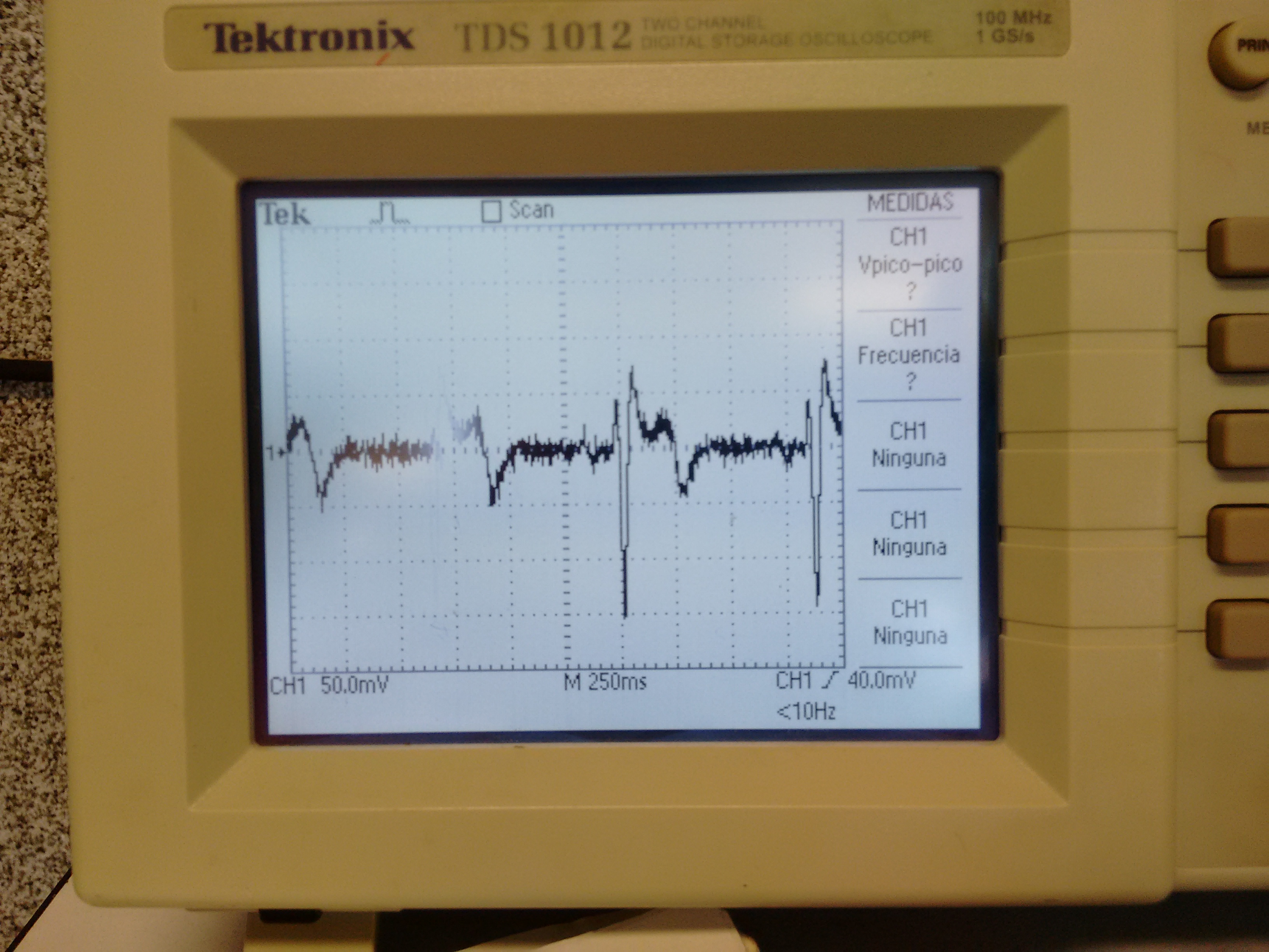 DIY ECG + Arduino + LabView | Trybotics